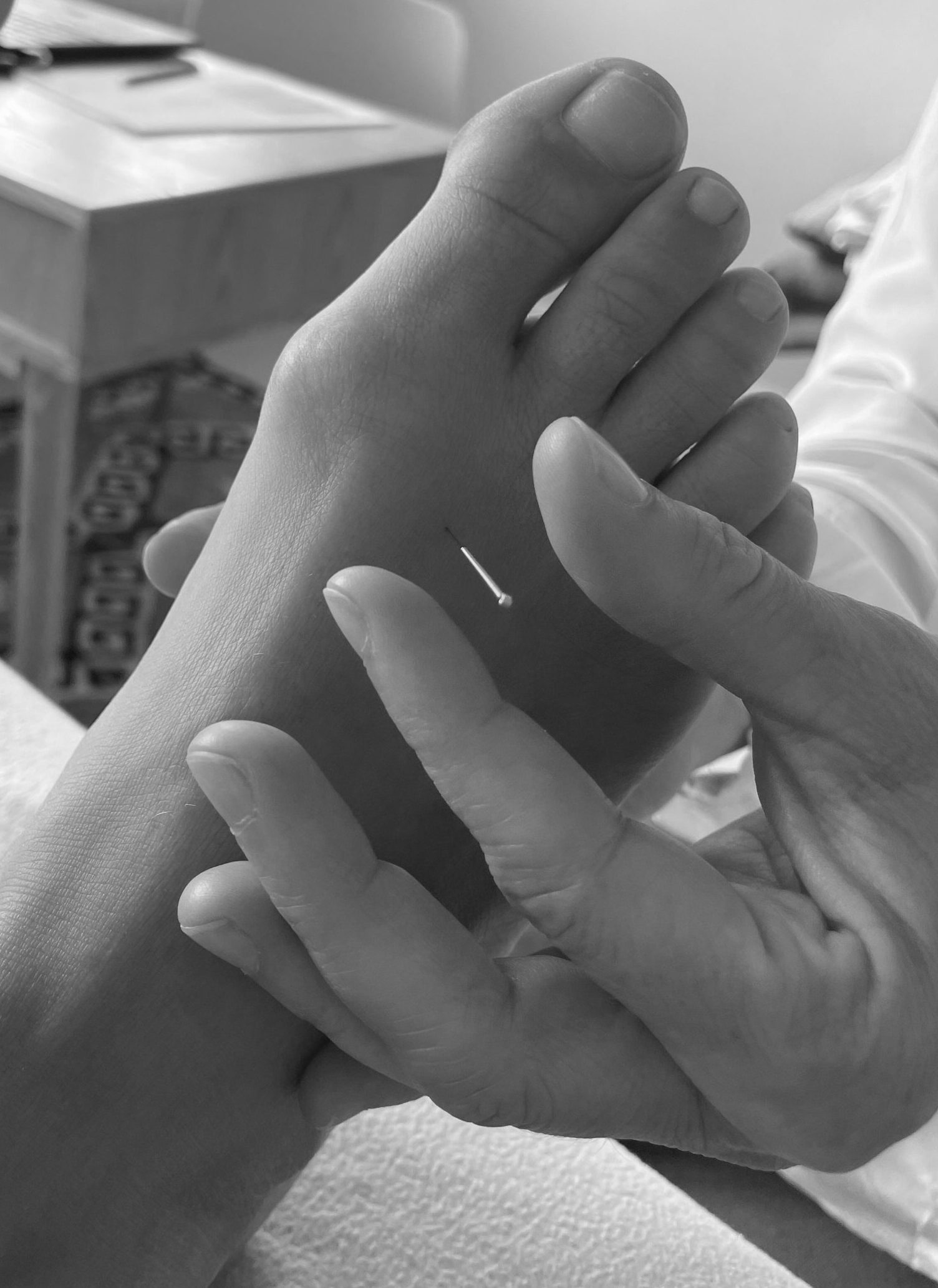 Om Akupunktur - AkupunkturMageriet